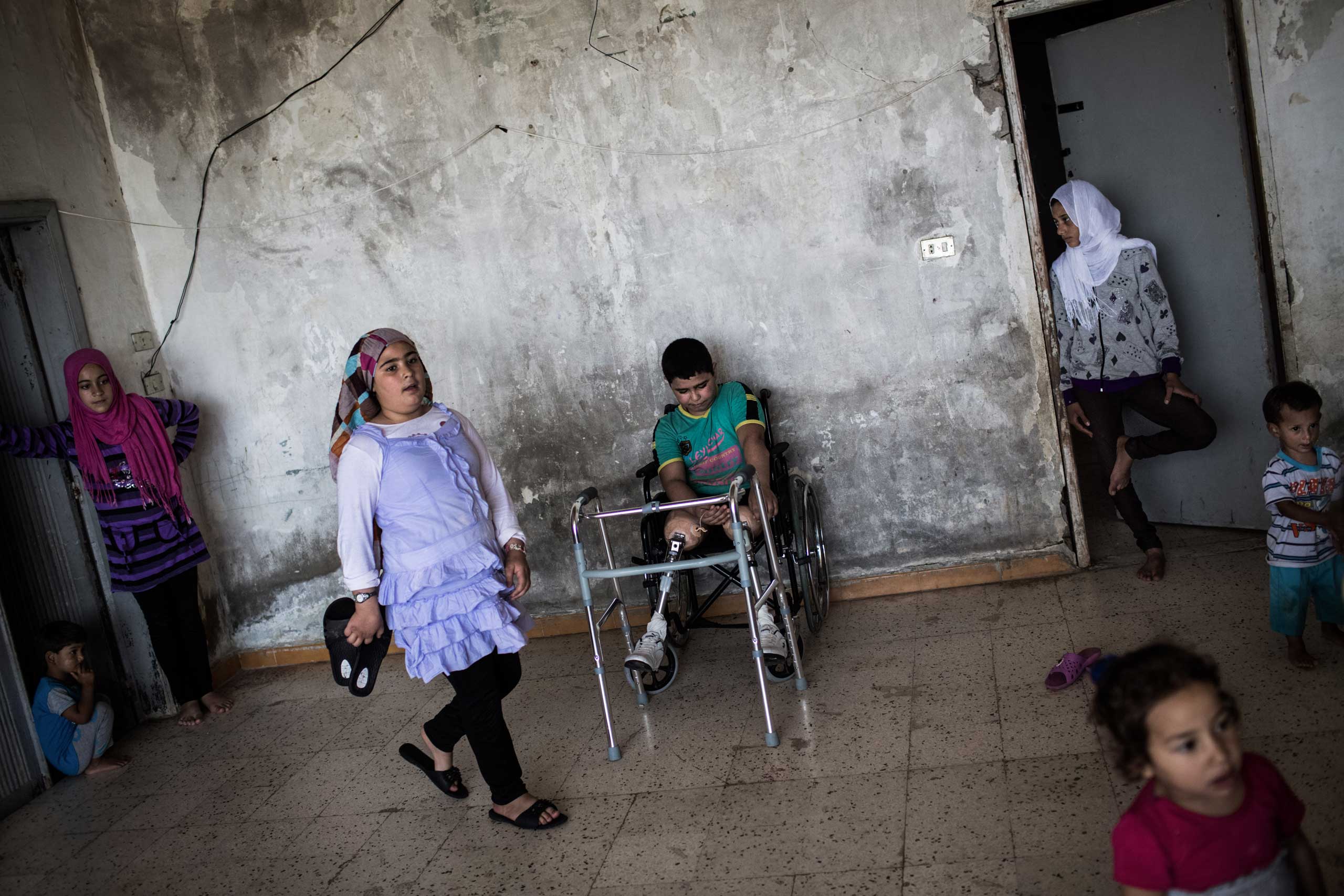 Injured Syrian Refugees in Lebanon Adjust to Life With Prosthetics