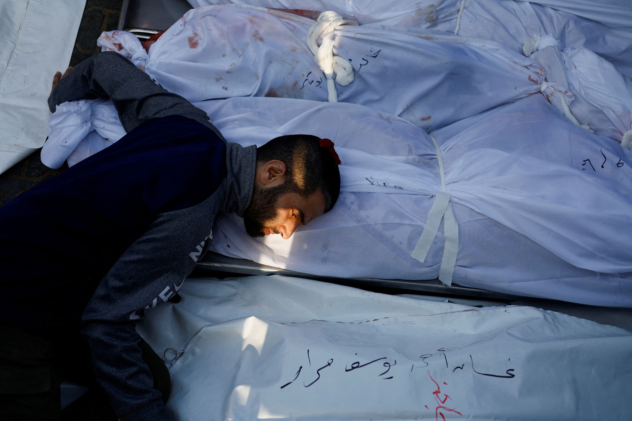 The Struggle to Save Lives Inside Gaza's Hospitals