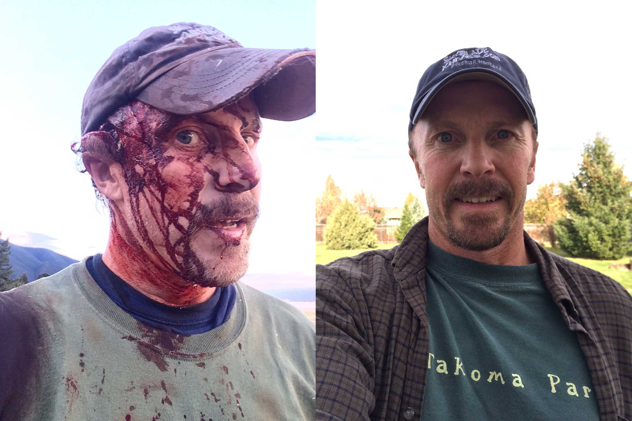 Bear Attack: Man Survived Attack by the Same Bear Twice