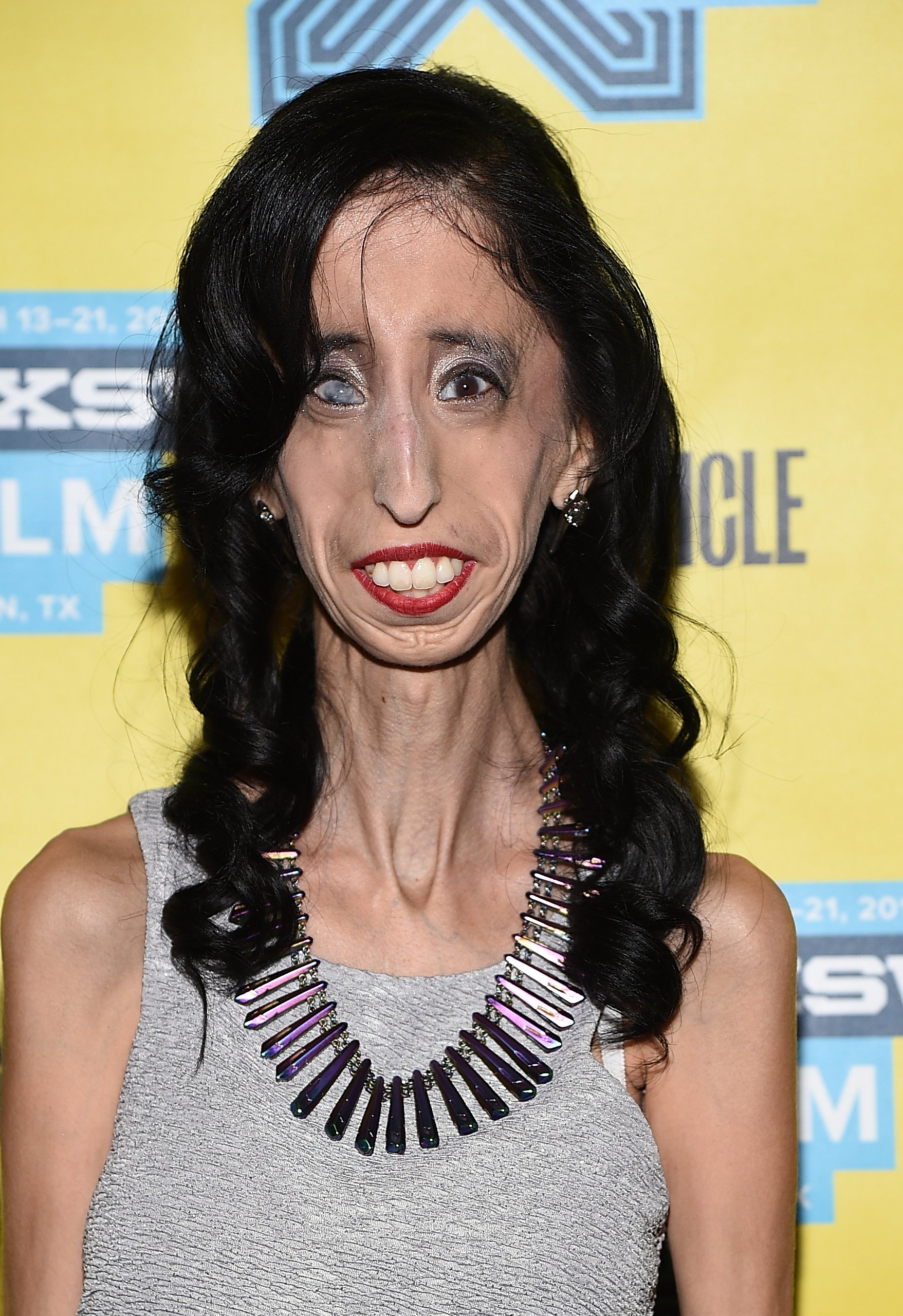 They Called Her the ‘World’s Ugliest Woman.’ It Only Made Her Stronger.