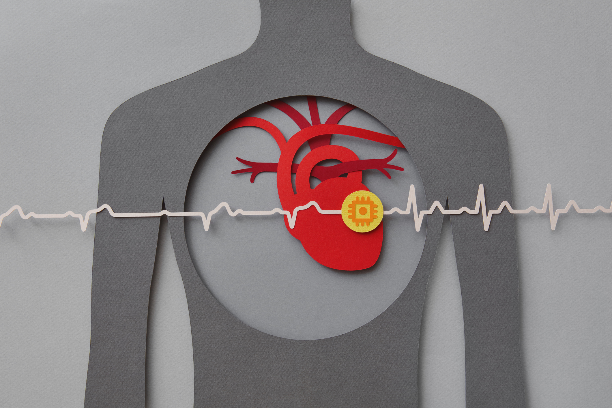 The Connection Between Diabetes and Heart Arrhythmias