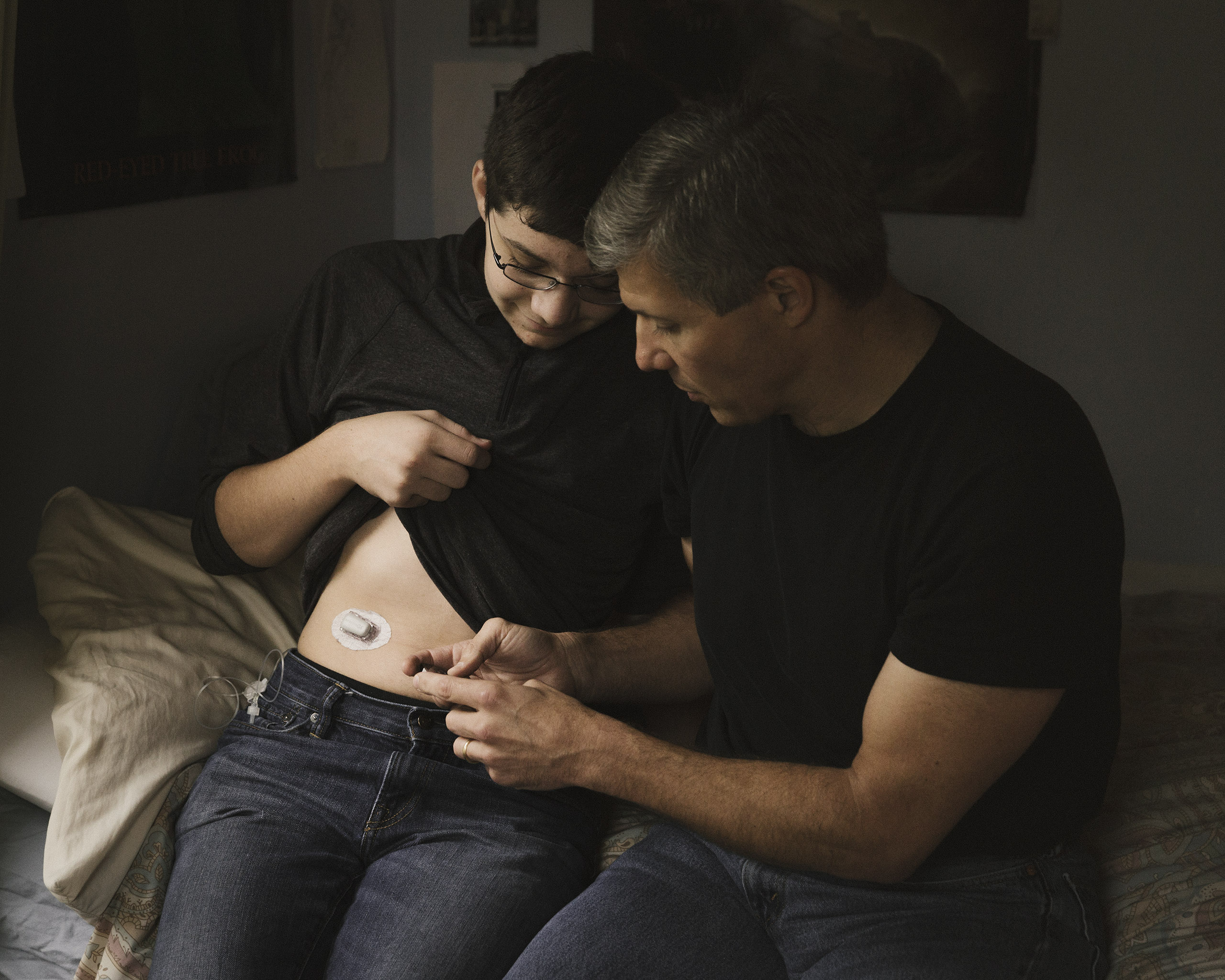 Bionic Pancreas: The Next Best Thing to a Cure for Diabetes