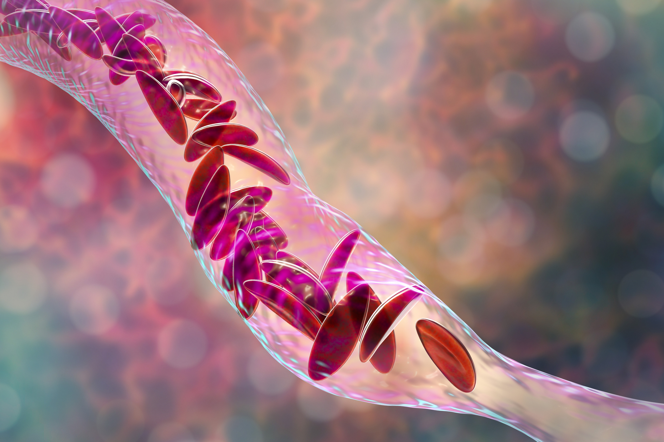 FDA Approves First CRISPR Treatment in U.S.